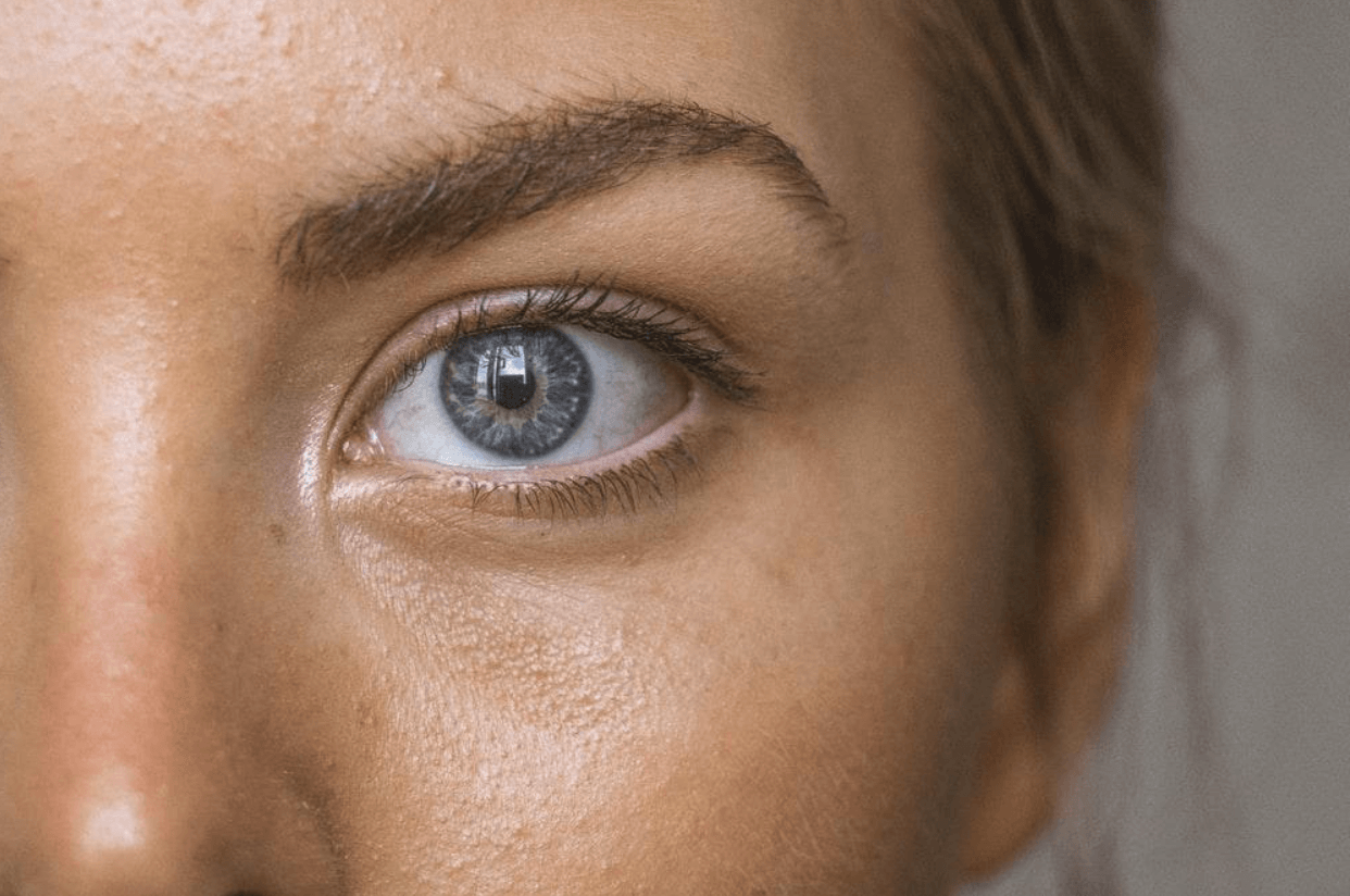 The Causes Behind Puffy Bags Under the Eye, and How to Treat Them ...